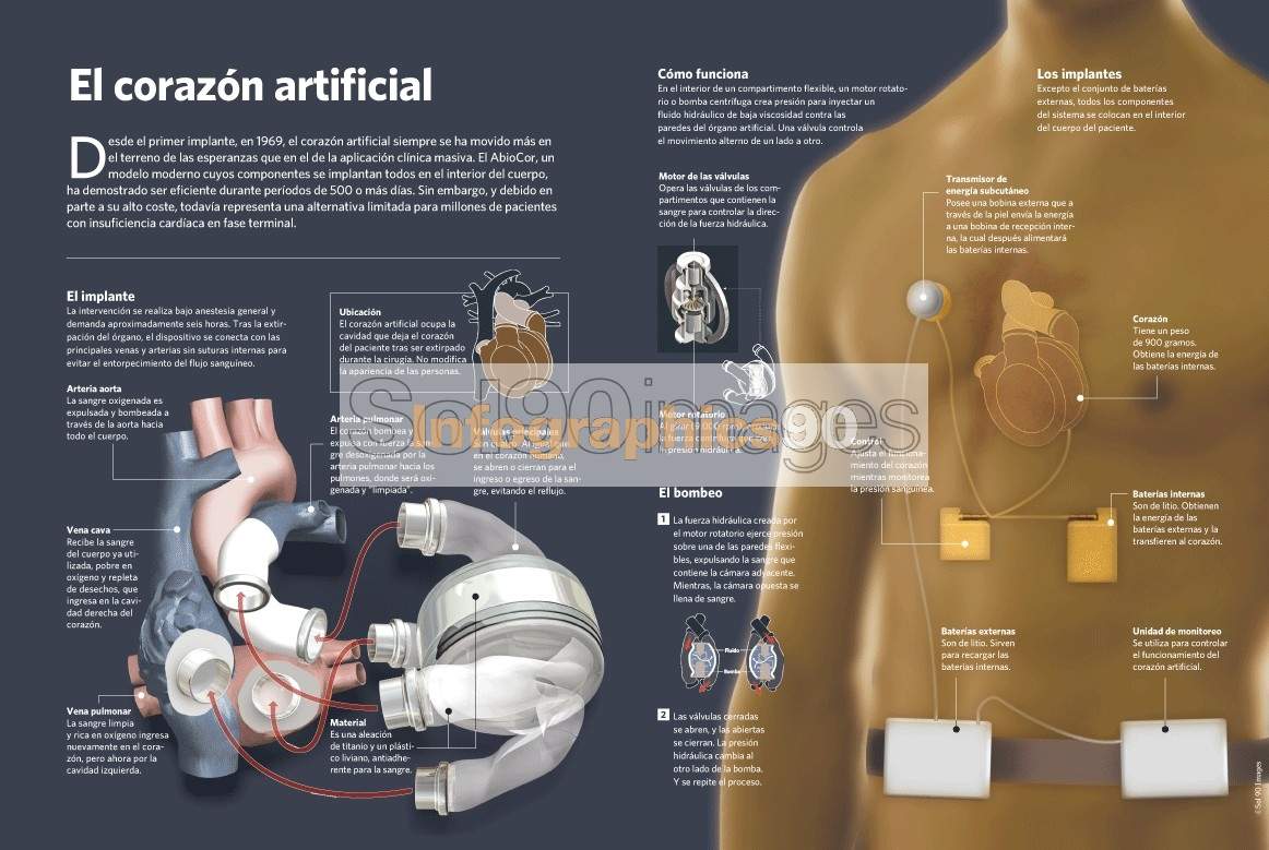 Infografía El Corazón Artificial | Infographics90