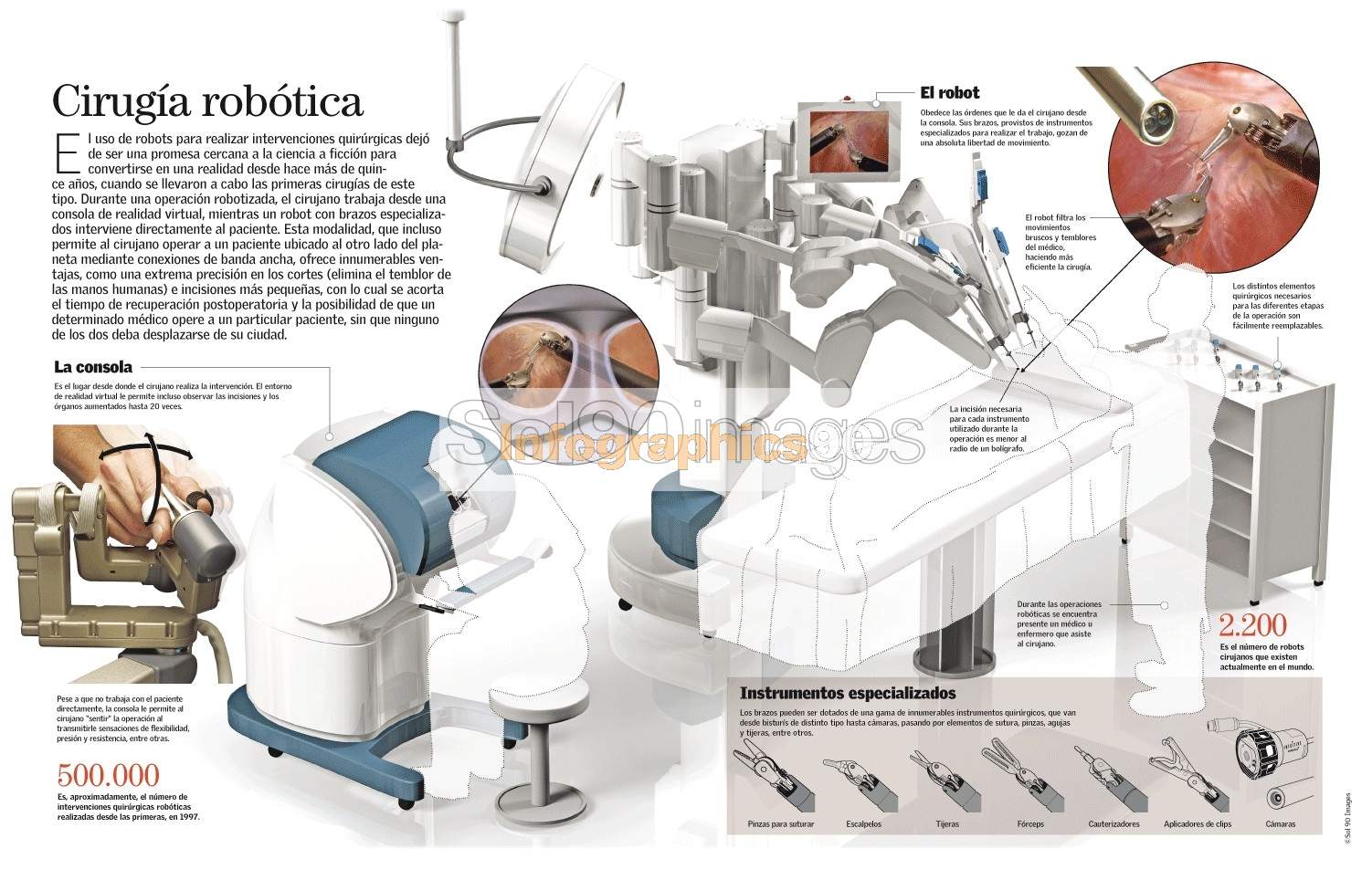 Infografía Cirugía Robótica | Infographics90