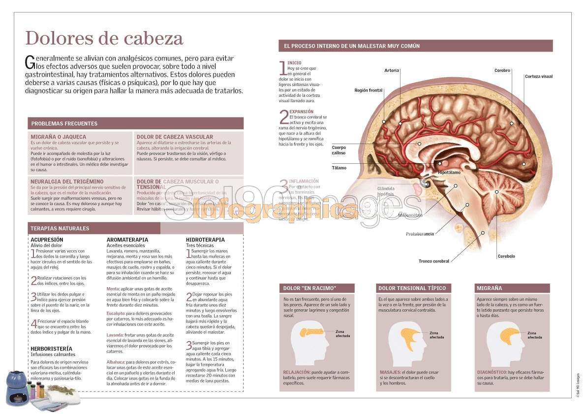 Infografía Dolores De Cabeza | Infographics90