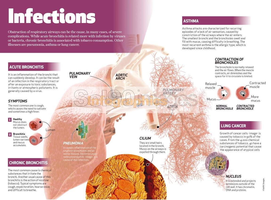 Infografía Infecciones | Infographics90