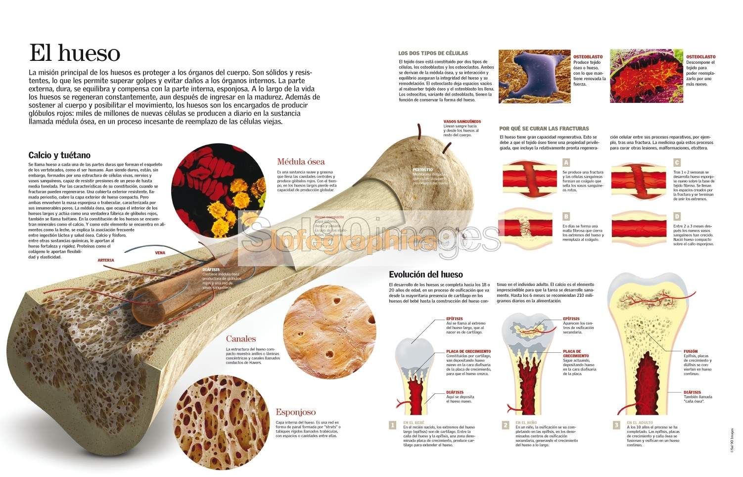 Infografía El Hueso | Infographics90