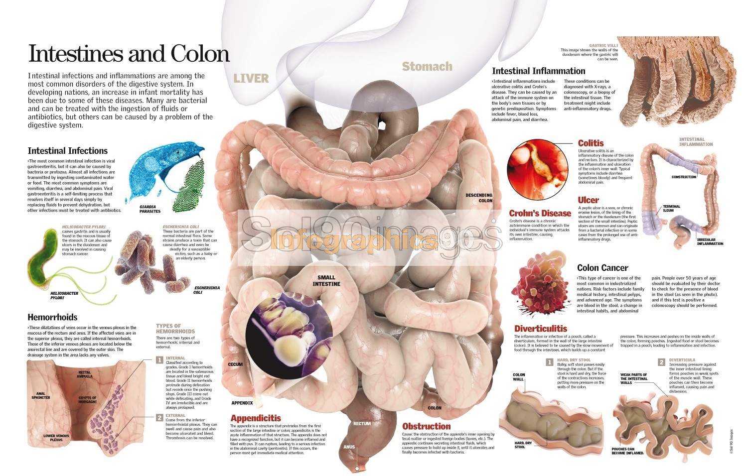 Infografía Intestino Y Colon | Infographics90